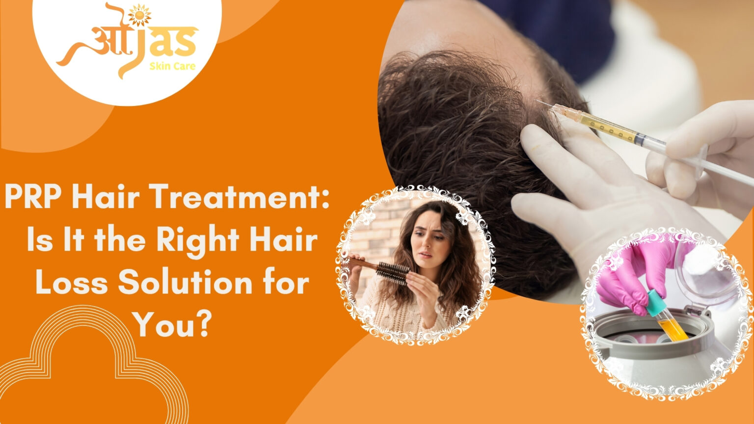 PRP Hair Treatment Is It the Right Hair Loss Solution for You? - Ojas ...
