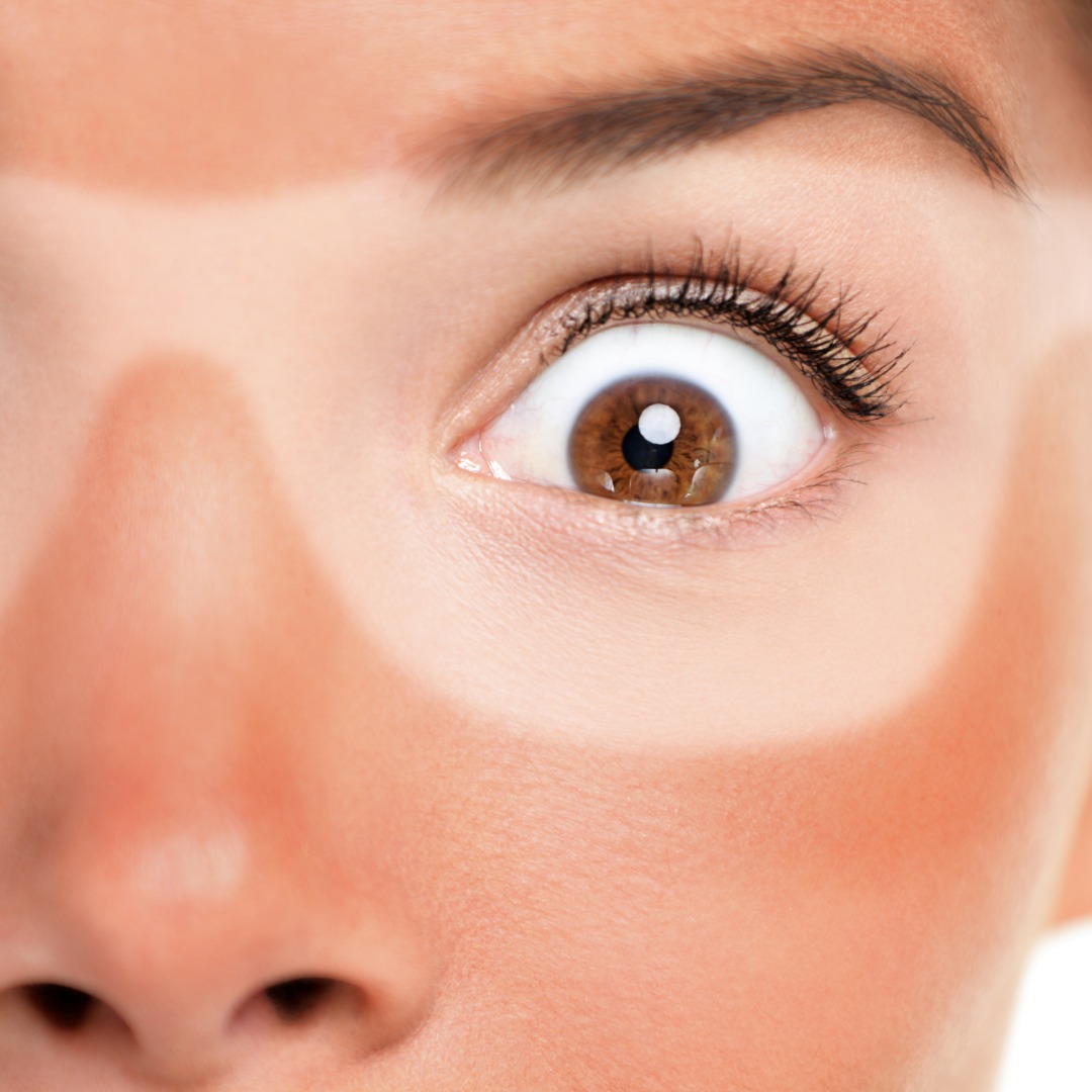 Radiant Skin 101: Your Guide To Banishing Pimples, Sun Tan, And ...